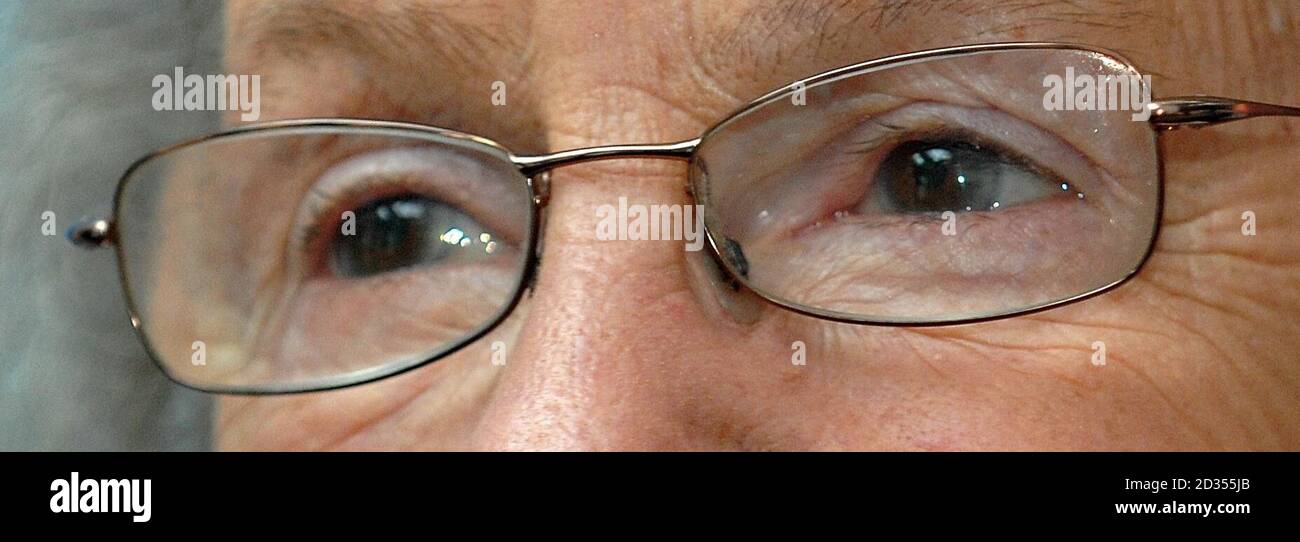 La victime dégénérative de la maladie oculaire et l'ancienne députée ...