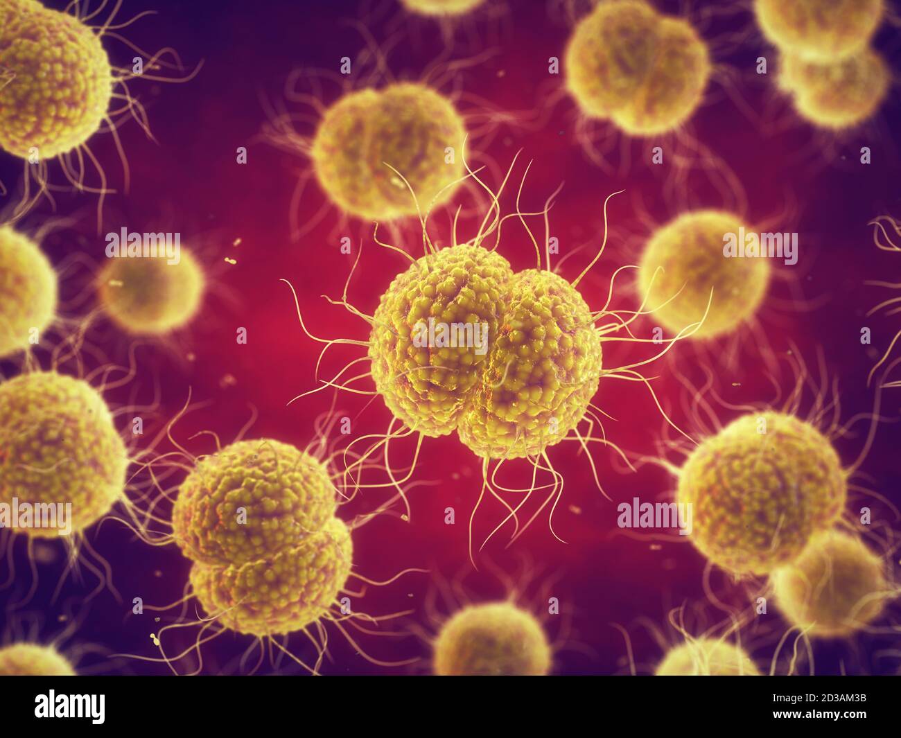 La Gonorrhée est une maladie transmise sexuellement causée par la ...