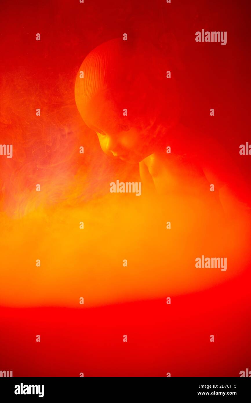 Placenta humain placenta humain Banque de photographies et d’images à ...