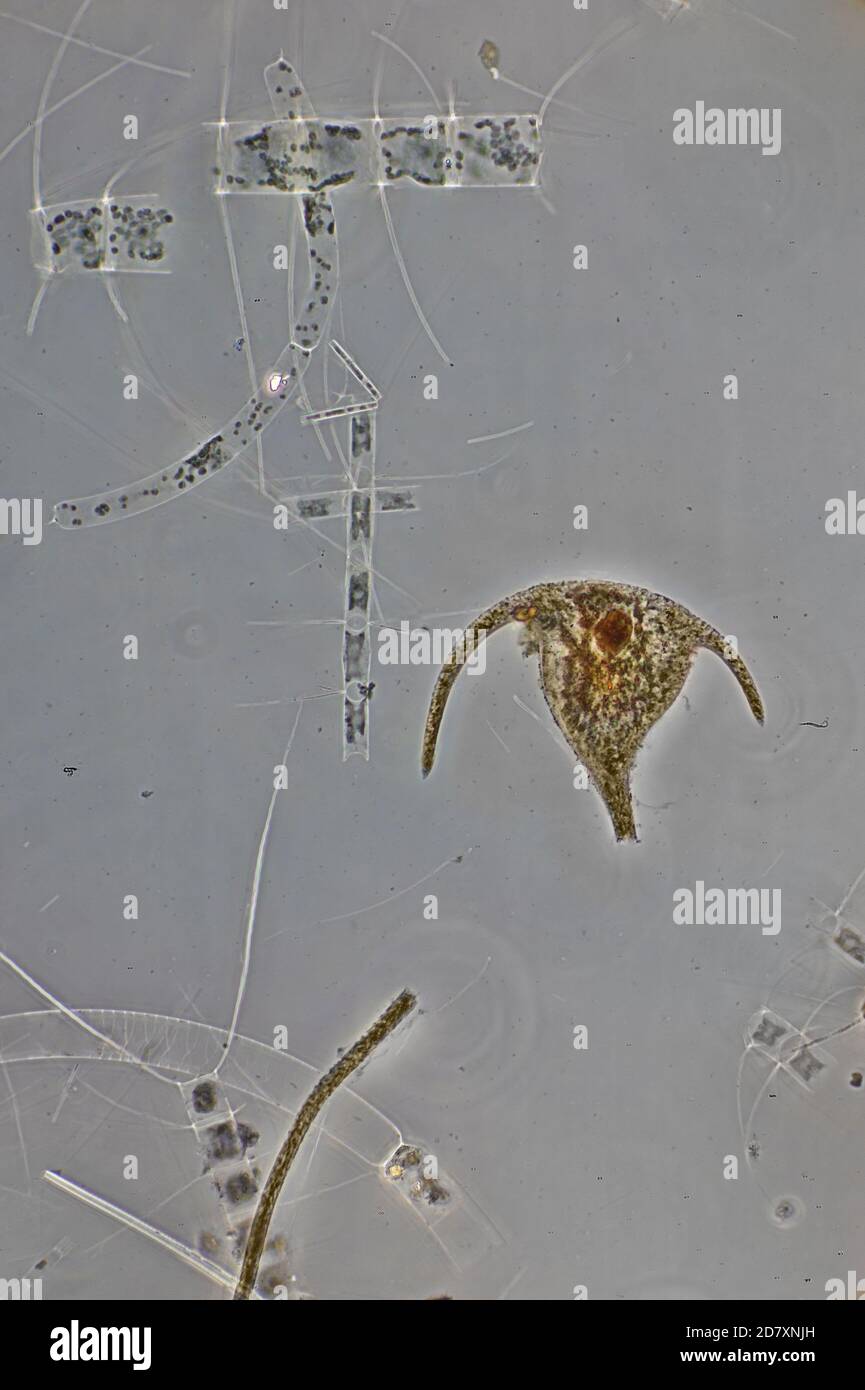 Phytoplancton marin, Bacteriastrum, Naples, MILIEU des années 1800 ...
