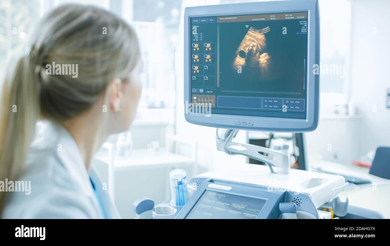 Scan foetus 3d Banque de photographies et d’images à haute résolution ...
