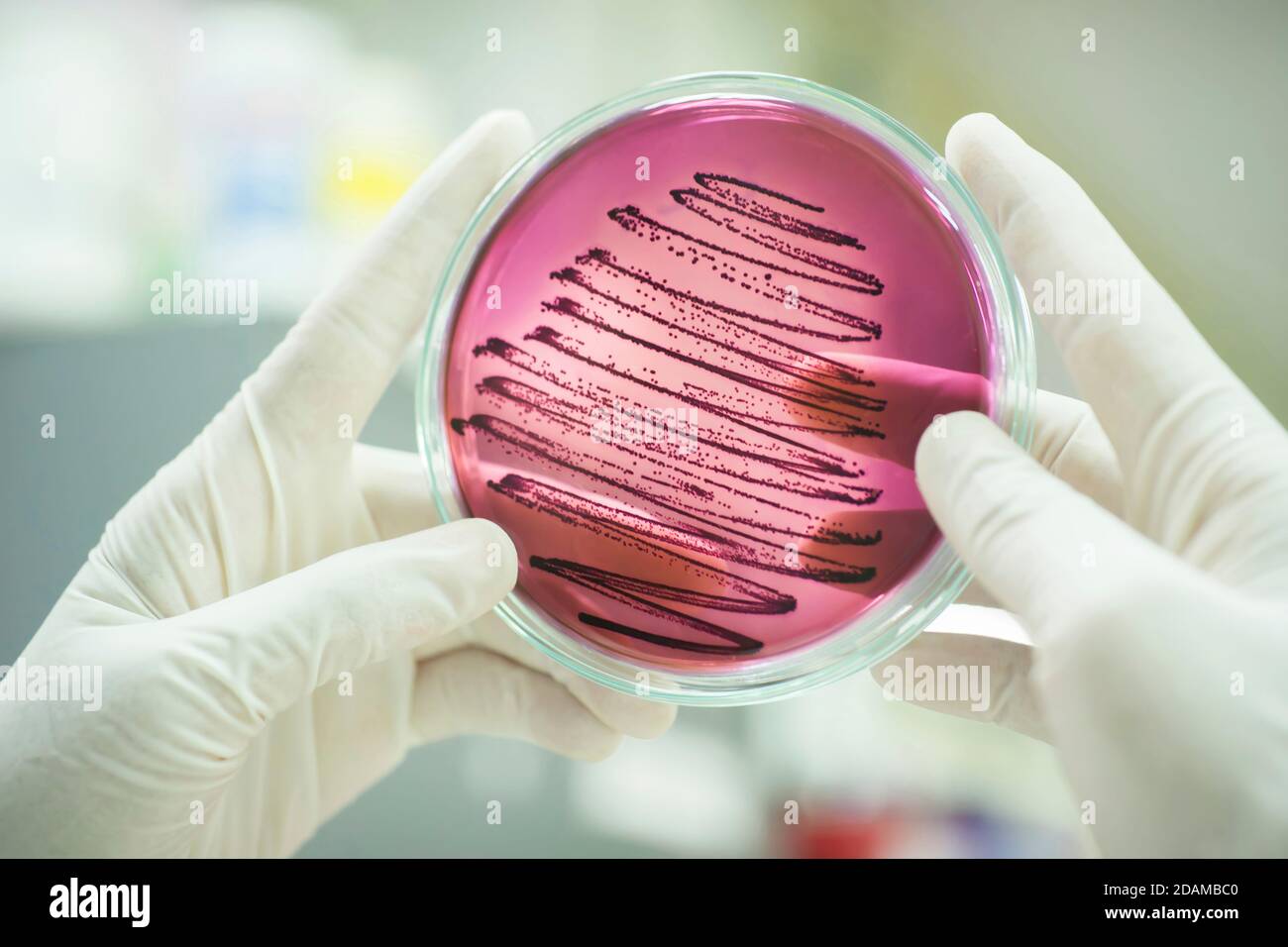 Culture bactérienne Banque de photographies et d’images à haute ...