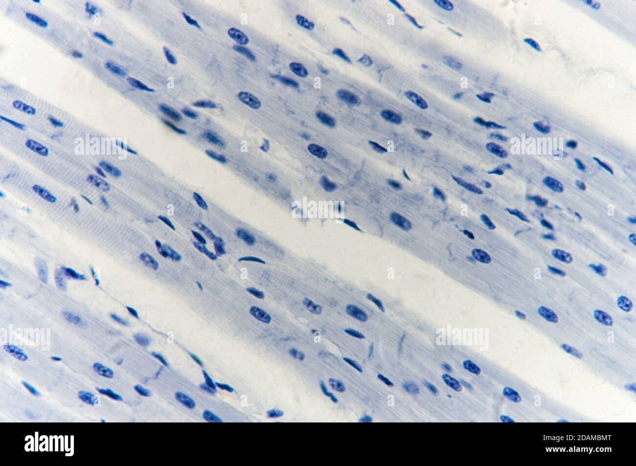 Les tissus musculaires stcardiaques Banque de photographies et d’images ...