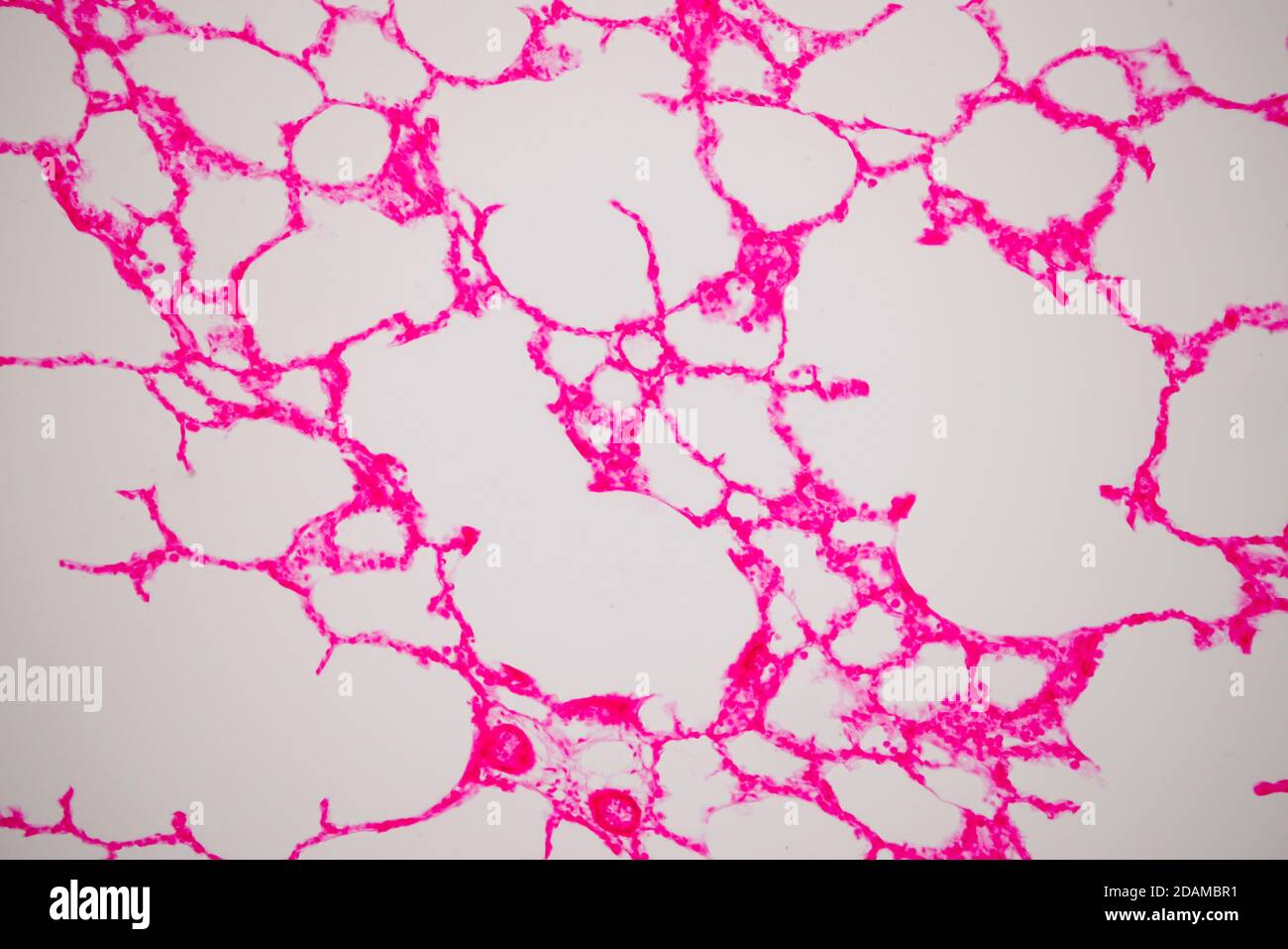 Anatomie et histologie du poumon humain Banque de photographies et d ...