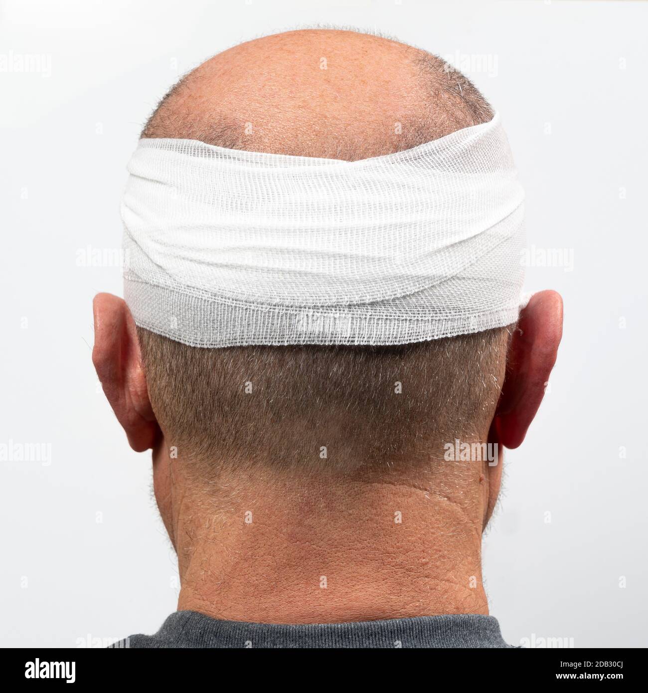 Tête bandée Banque de photographies et d’images à haute résolution - Alamy