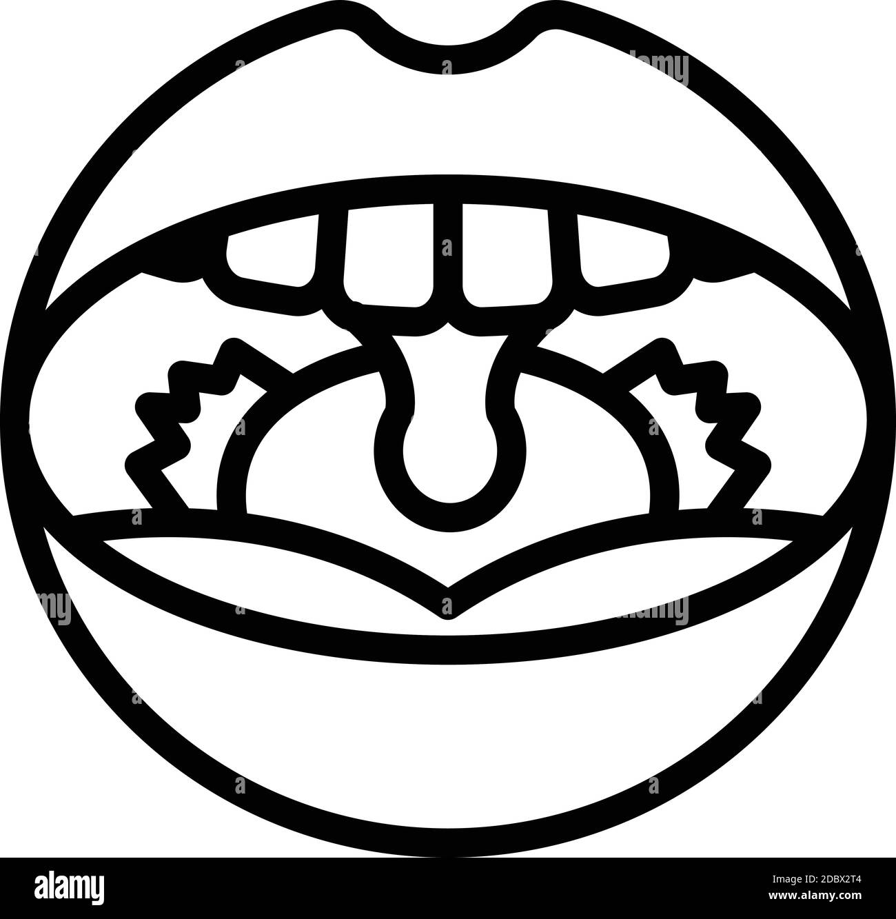 Amygdalite chronique Banque d'images vectorielles - Alamy