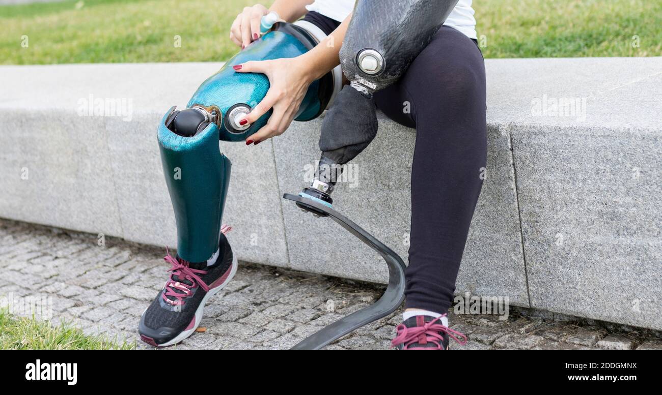 Non reconnaissable, la femme de la culture a changé de prothèse de ...