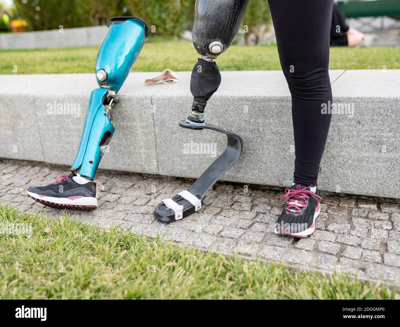 Non reconnaissable, la femme de la culture a changé de prothèse de ...