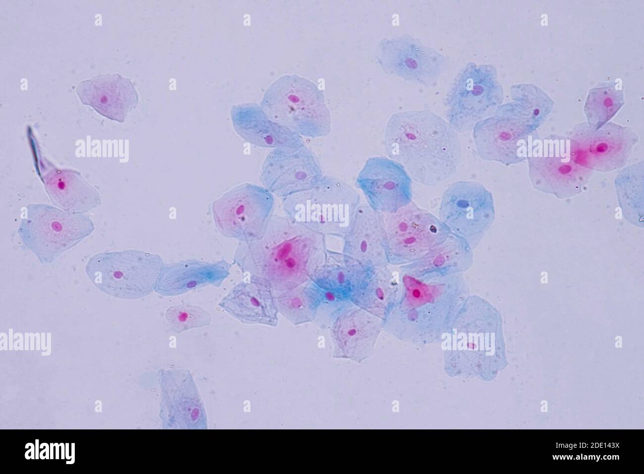 Cellules Squameuses Banque d'image et photos - Alamy