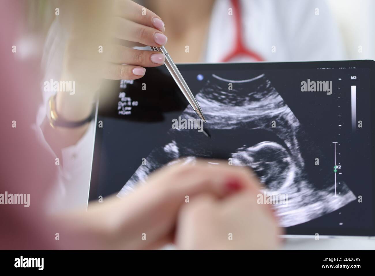 Le Médecin Montre à La Femme Enceinte Une échographie Du Fœtus Photo