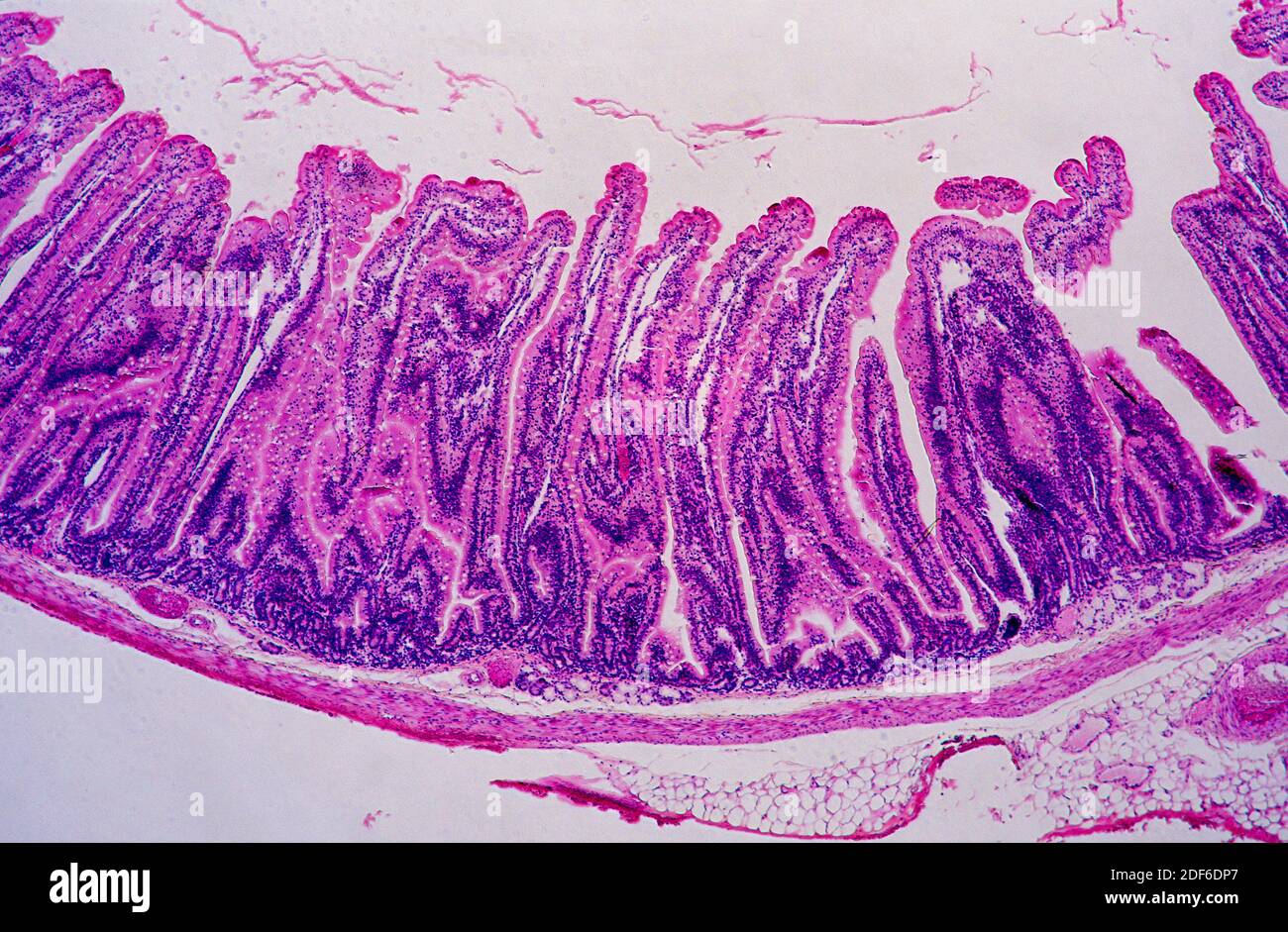 Cellule caliciforme intestinale Banque de photographies et d’images à ...
