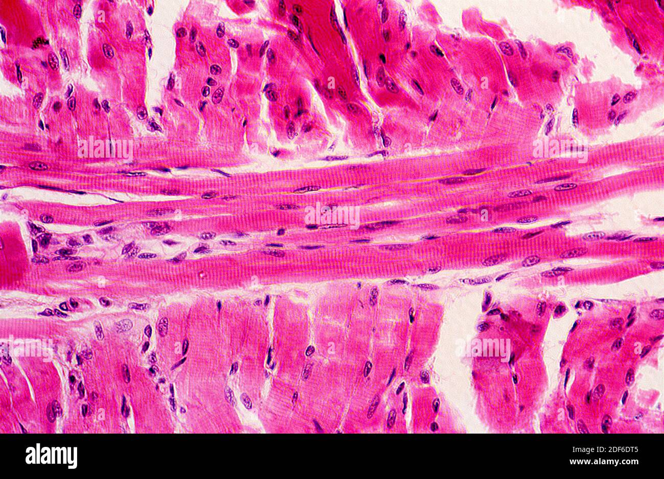 Muscle strié coupe transversale Banque de photographies et d’images à ...