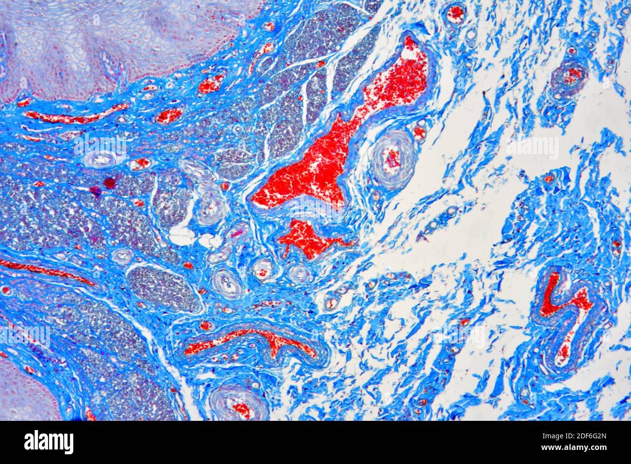 épithélium squameux stratifié Banque de photographies et d’images à ...