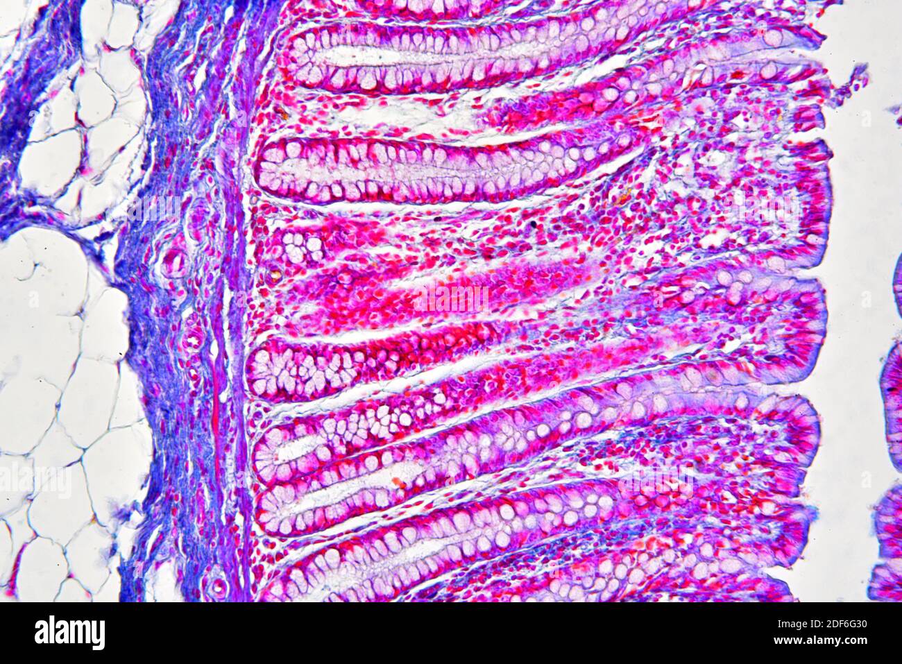 Histology intestinal villi Banque de photographies et d’images à haute ...