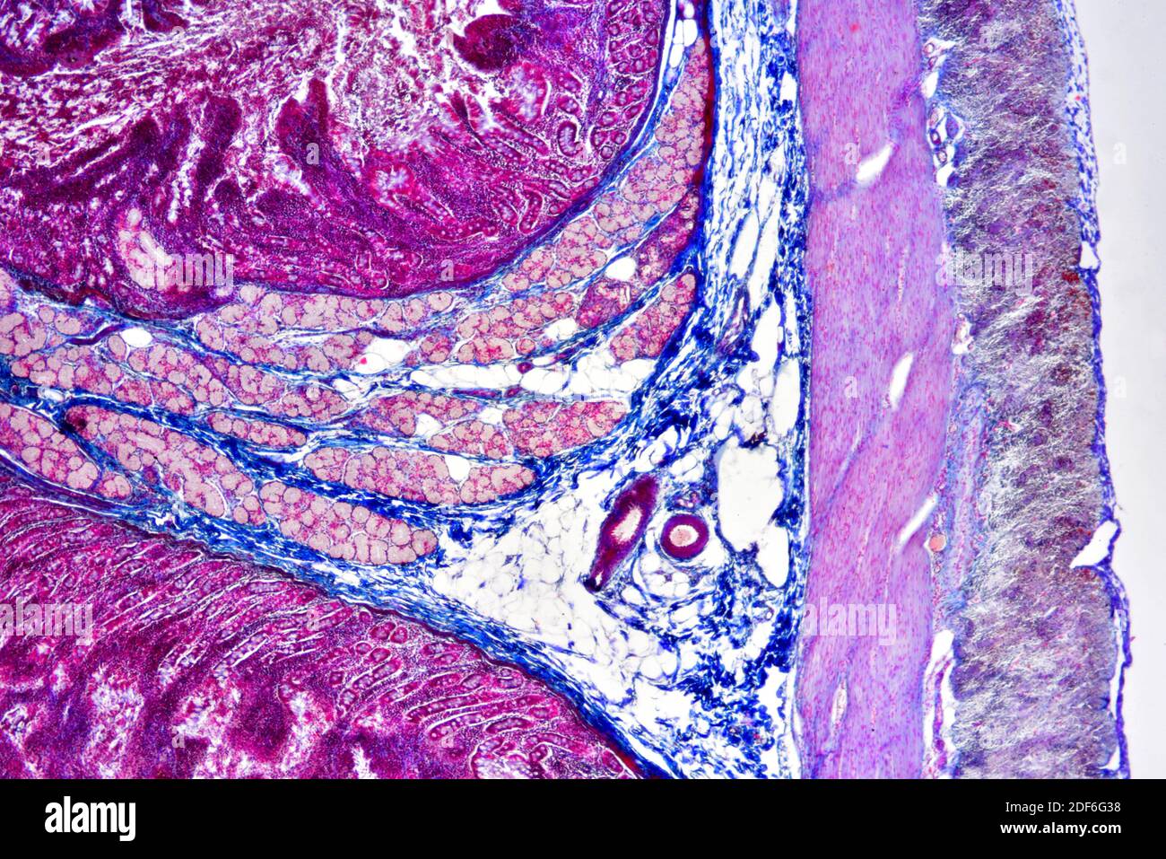 Duodenum And Mucosa Banque d'image et photos - Alamy