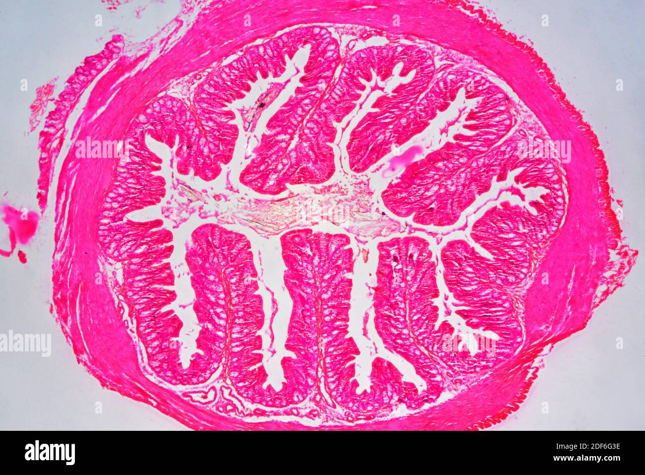 Lamina propria Banque de photographies et d’images à haute résolution ...