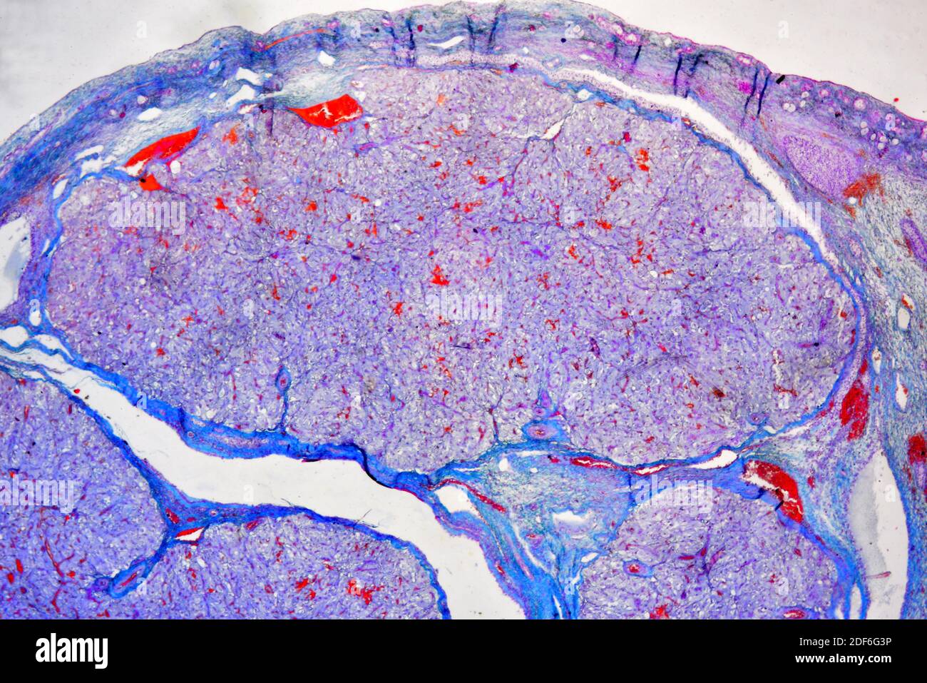 Histology ovary Banque de photographies et d’images à haute résolution ...