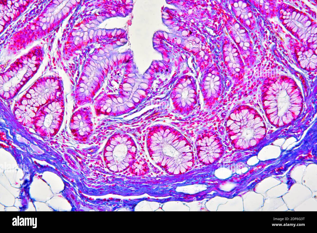 Intestinal epithelium Banque de photographies et d’images à haute ...