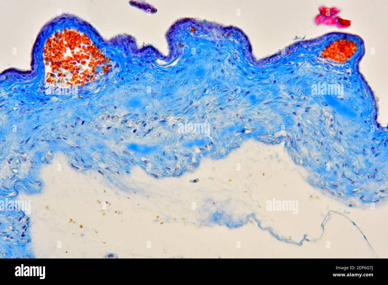 Placenta humain placenta humain Banque de photographies et d’images à ...