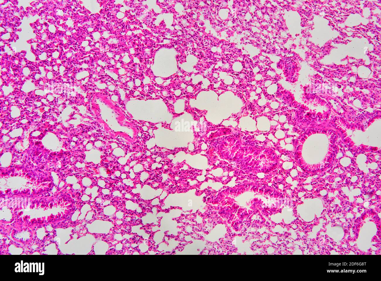 Les alvéoles pulmonaires Banque de photographies et d’images à haute ...