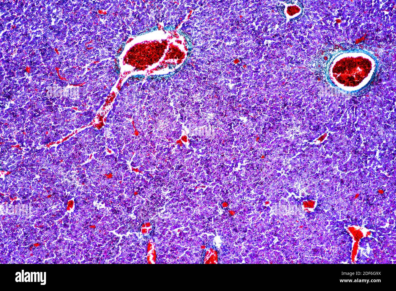 Sang humain microscope Banque de photographies et d’images à haute ...