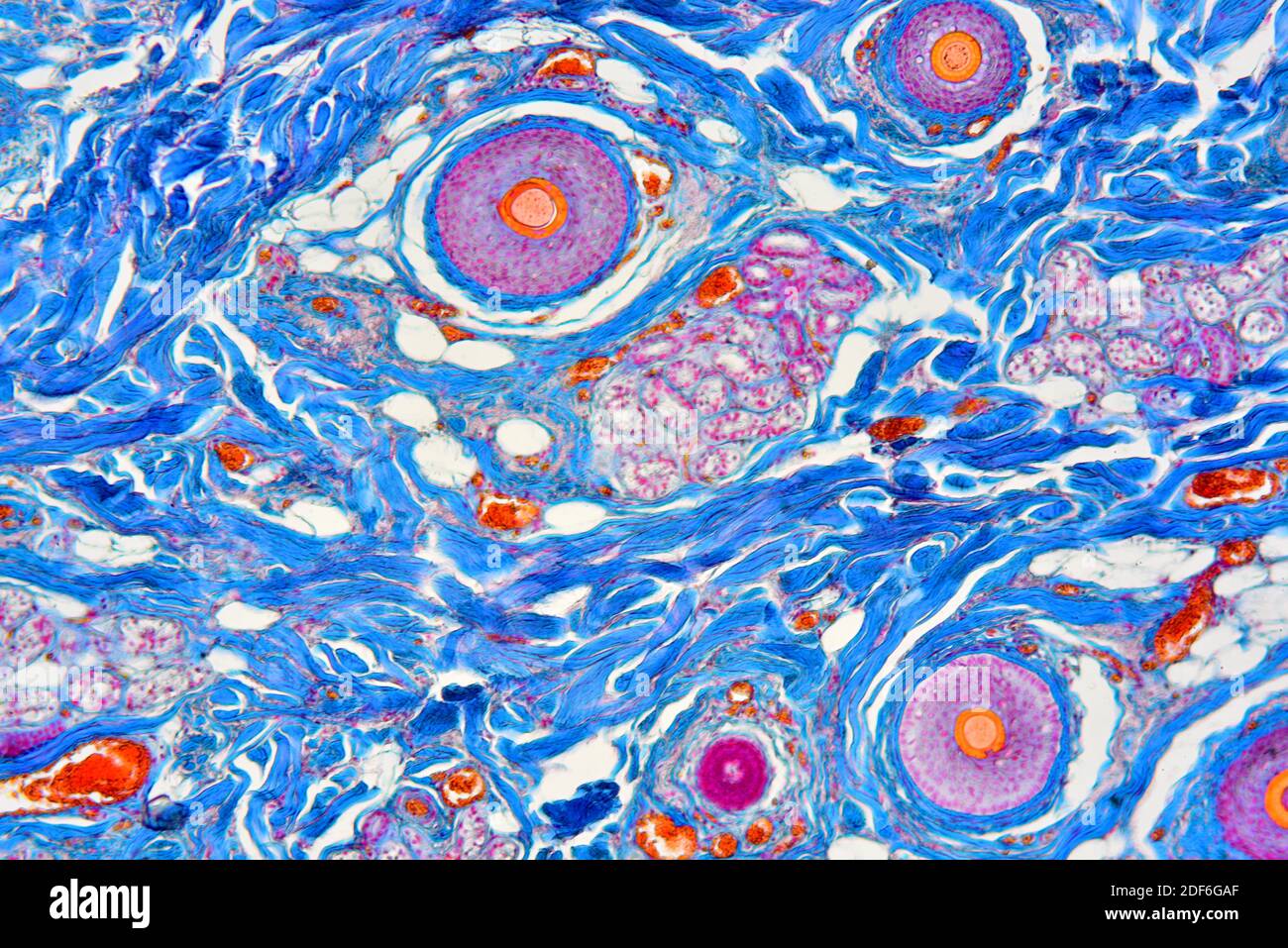 Glande sébacée microscope Banque de photographies et d’images à haute ...