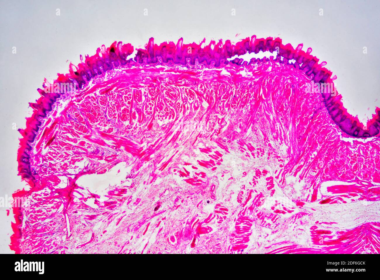 Papille gustative Banque de photographies et d’images à haute ...