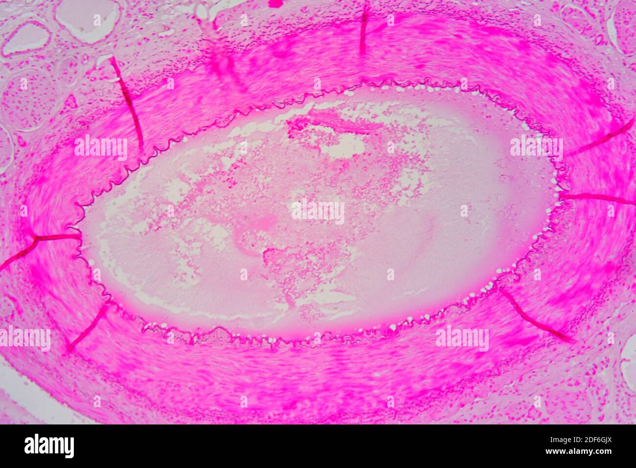 Venule (vaisseau sanguin). Microscope optique X100 Photo Stock - Alamy