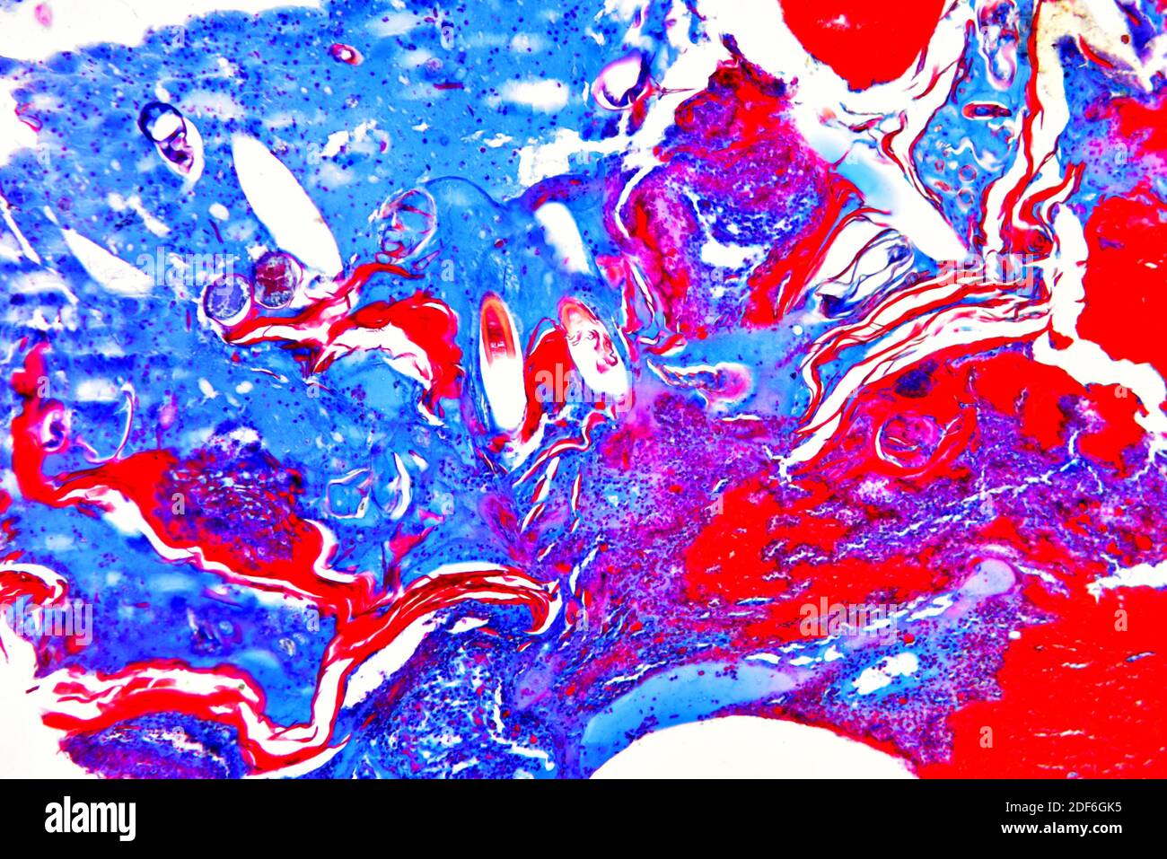 Mite Microscope Banque d'image et photos - Alamy