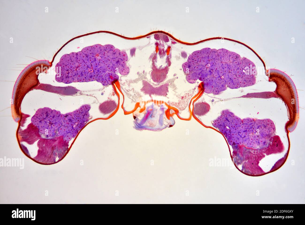 Section du nerf optique Banque de photographies et d’images à haute ...