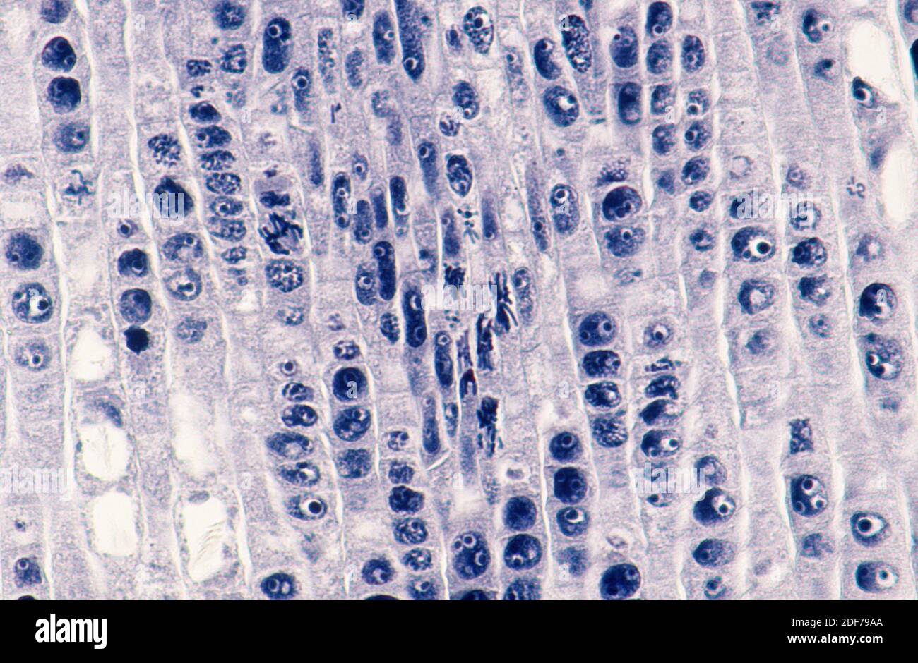 Méristème apical racinaire Banque de photographies et d’images à haute ...