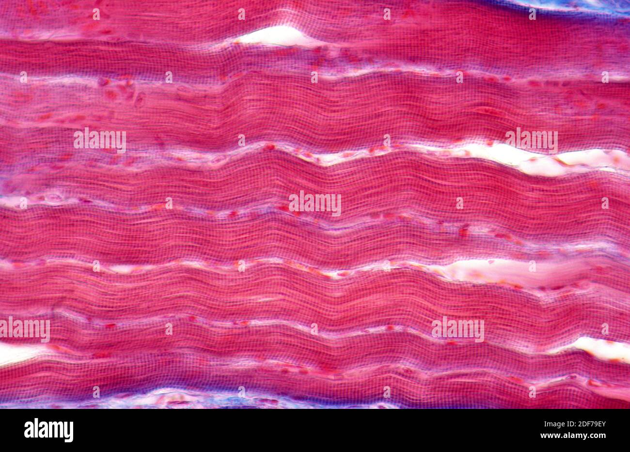 Skeletal Muscle Micrograph Banque d'image et photos - Alamy