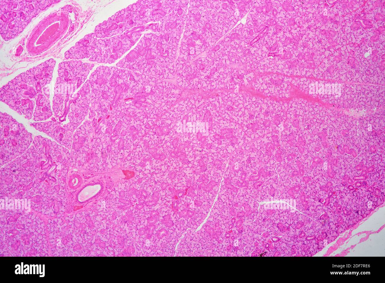 Glande salivaire histologie Banque de photographies et d’images à haute ...