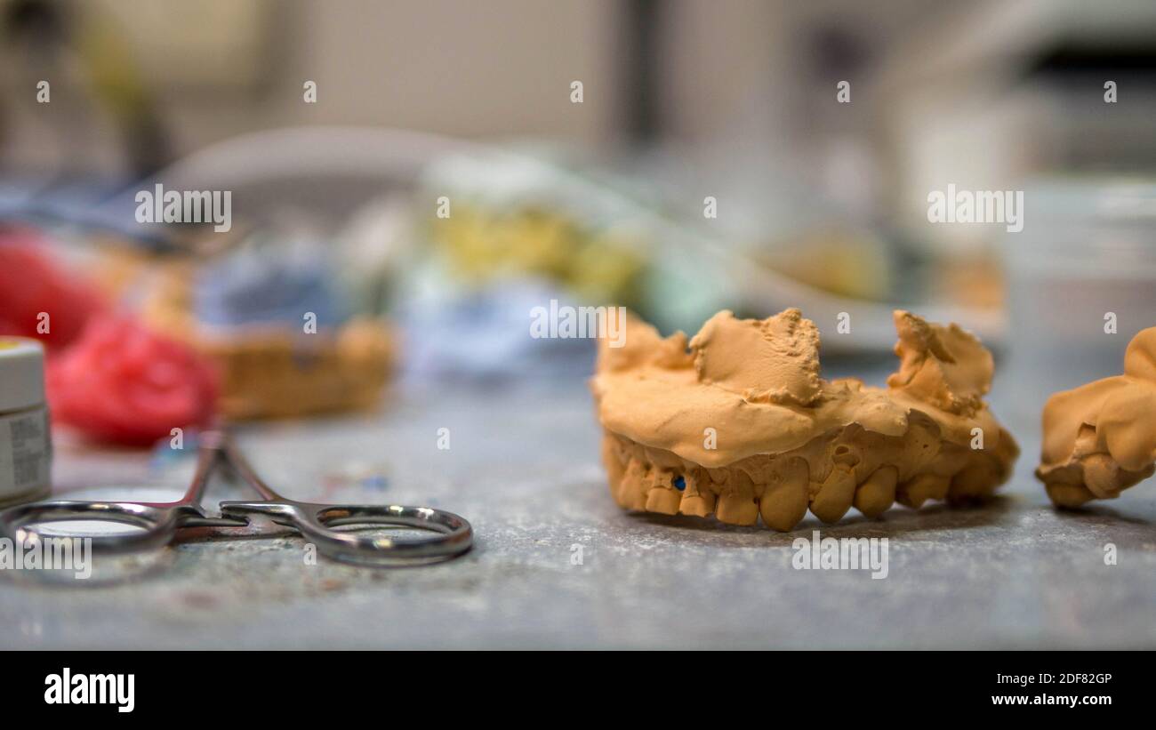 Modèle de plâtre de dents sur une table de travail, un technicien ...