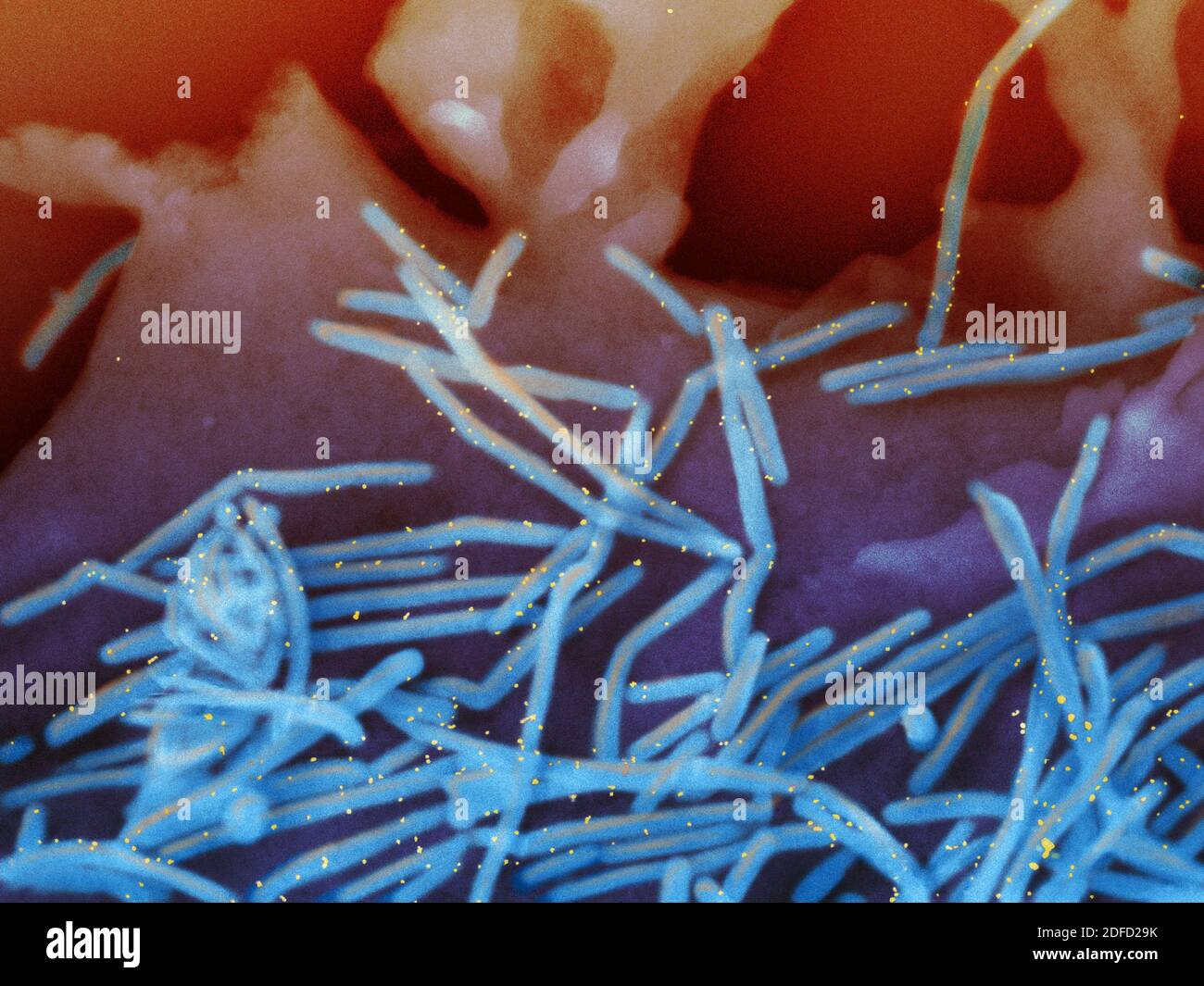 Scanning electron microscope lung Banque de photographies et d’images à ...