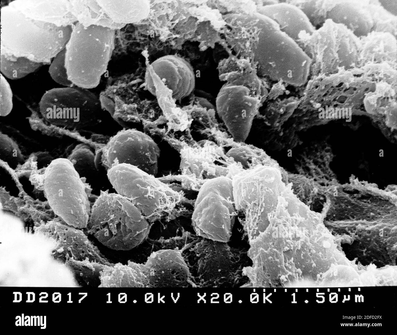 Yersinia pestis Banque de photographies et d’images à haute résolution ...