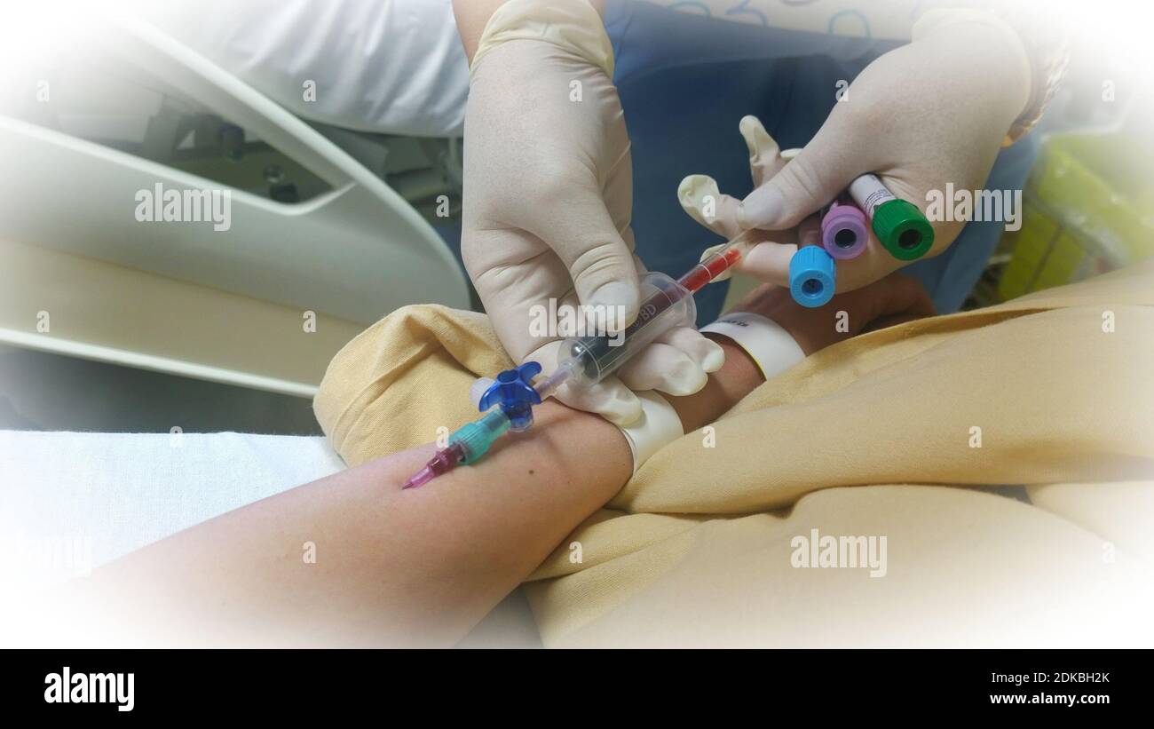 Catheter Drip Venous Banque d'image et photos - Alamy
