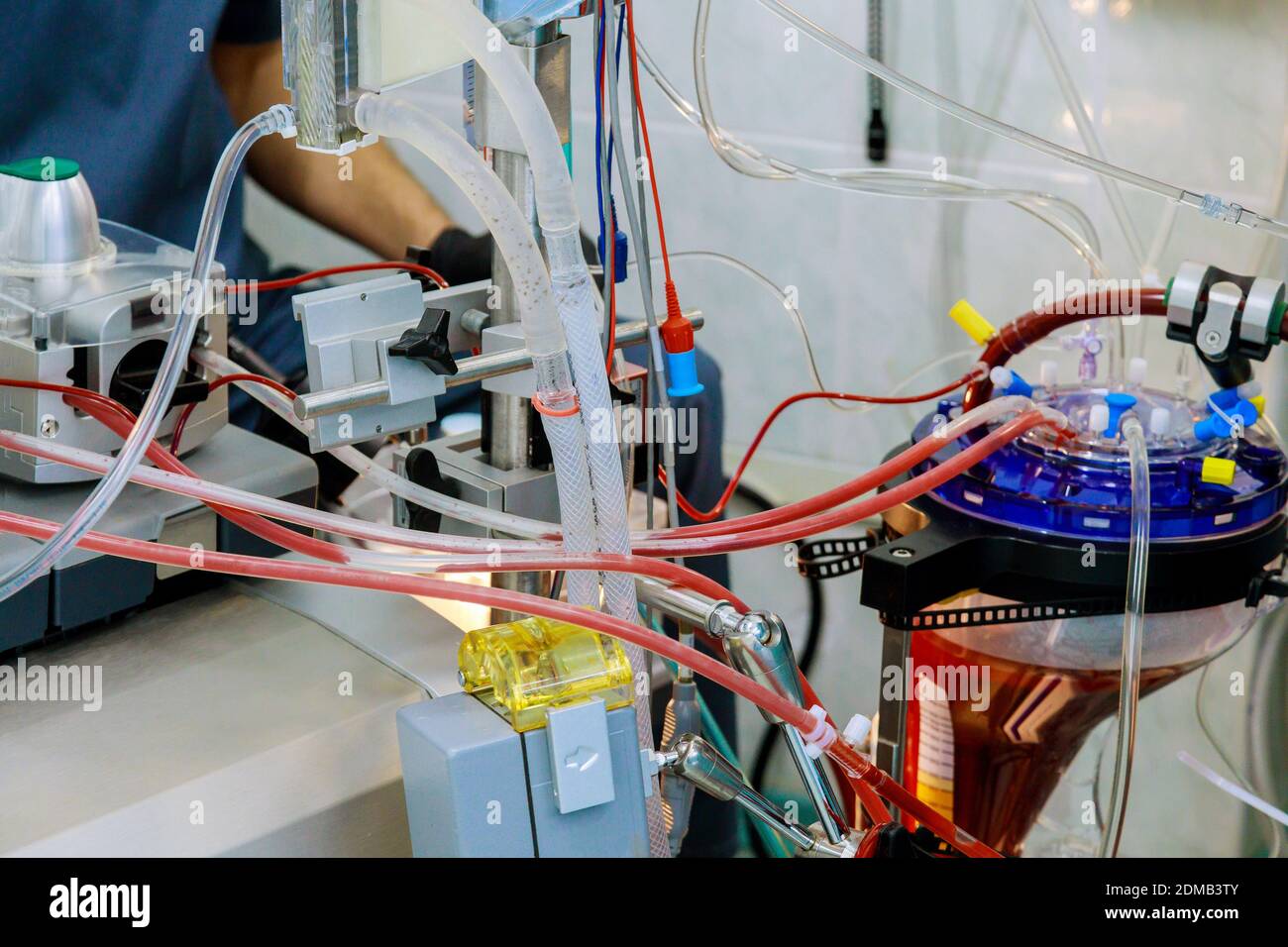 Salle d'opération pendant la chirurgie cardiaque dans la machine ...