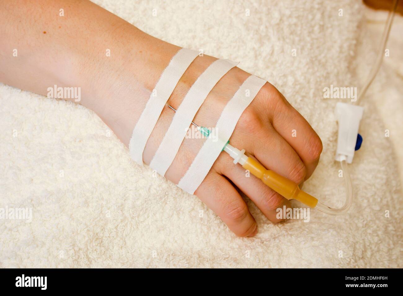 Thérapie Par Perfusion Banque d'image et photos - Alamy