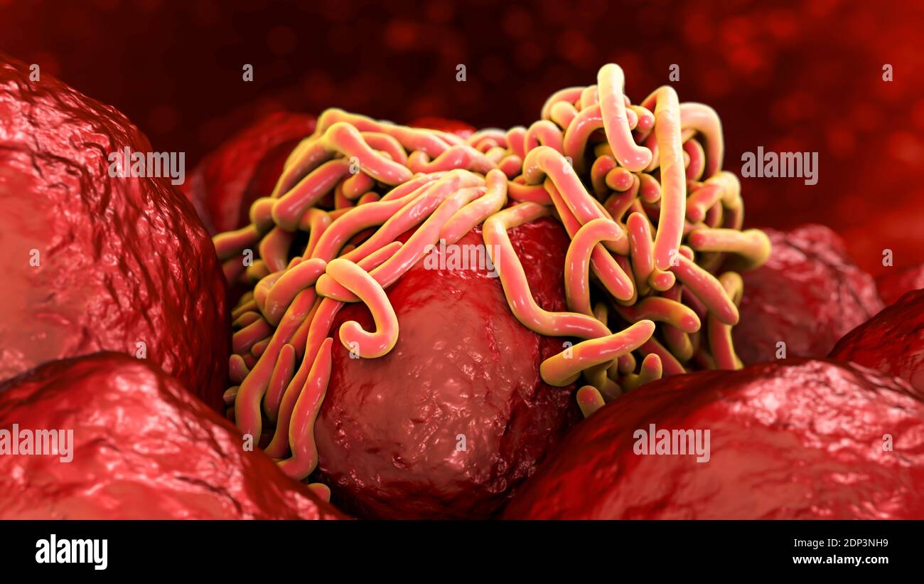 Vers intestinaux humain ronds Banque de photographies et d’images à ...
