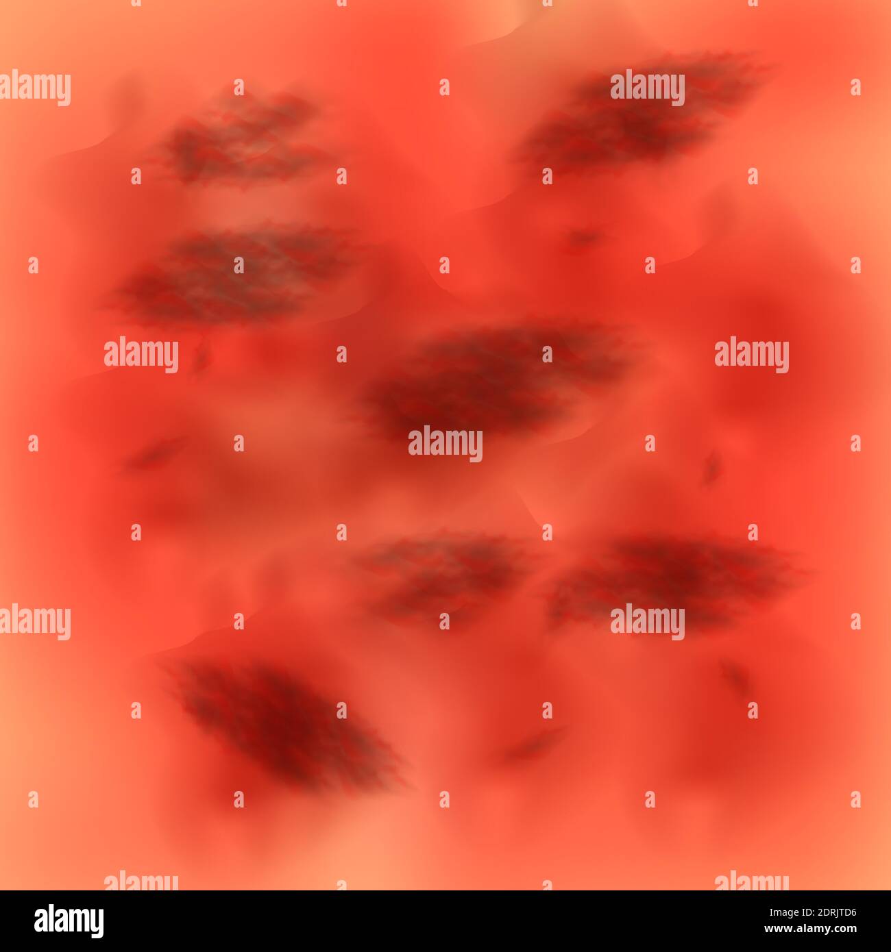 Inflammation de la peau, erysipelas. Psoriasis, séborrhée, dermatite ...