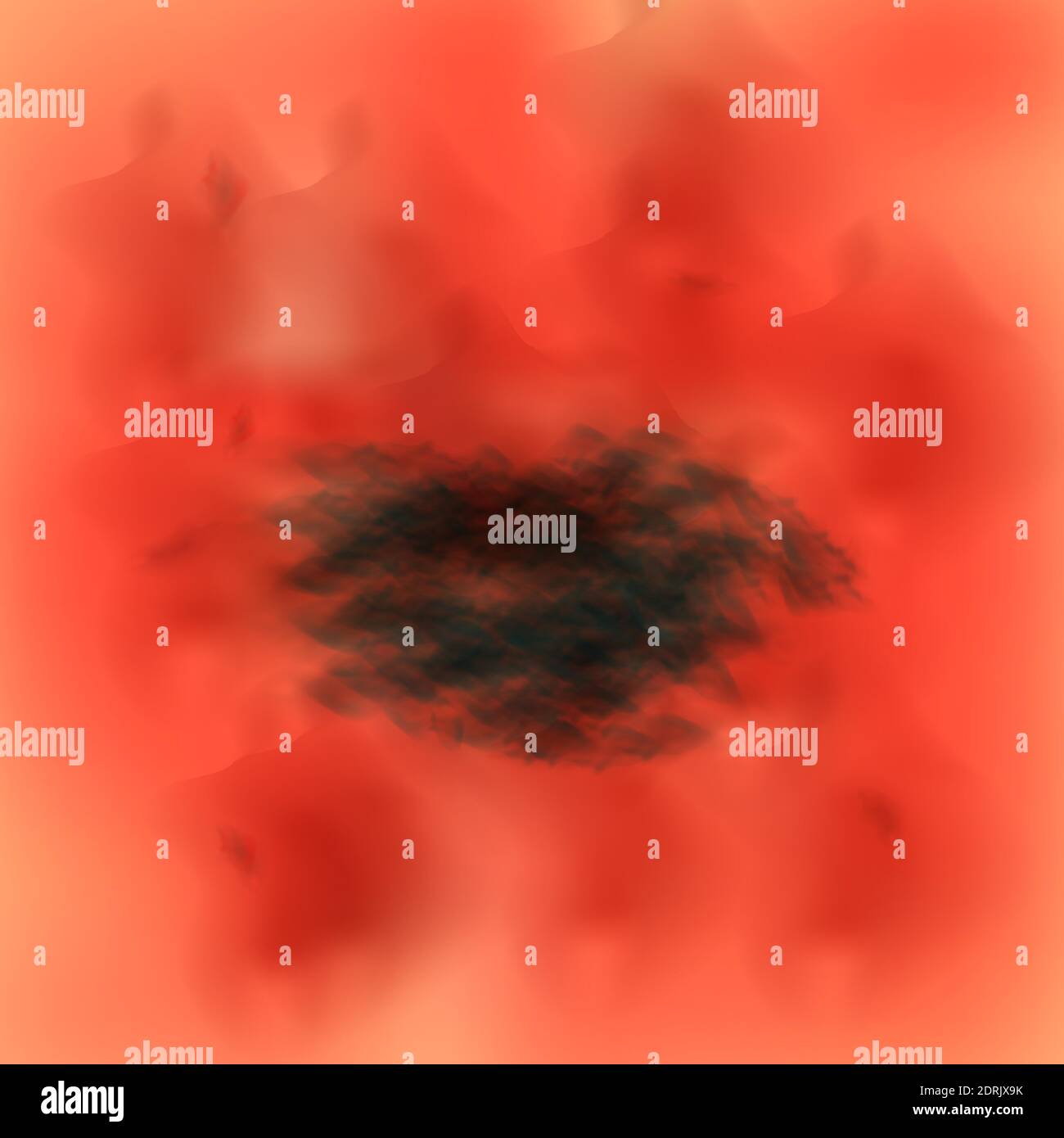 Inflammation de la peau, erysipelas. Psoriasis, séborrhée, dermatite ...