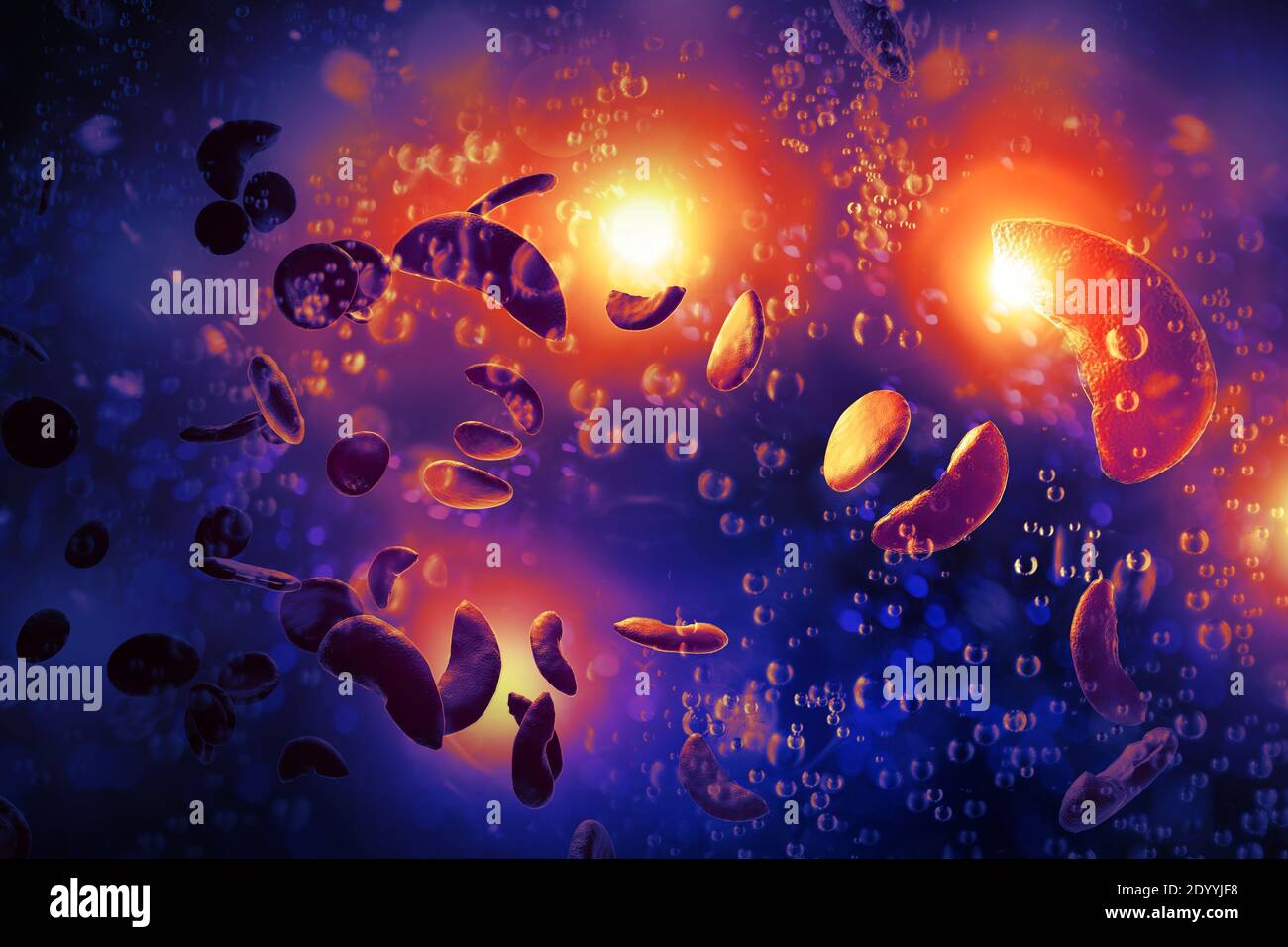 Drépanocytose maladie (IFL) globules rouges 3D illustration Photo Stock ...