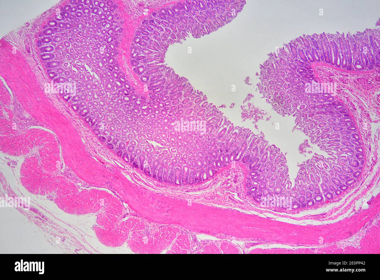 Sistema muscular humano Banque de photographies et d’images à haute ...