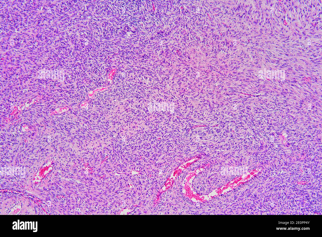 Ovaire humain histologie Banque de photographies et d’images à haute ...