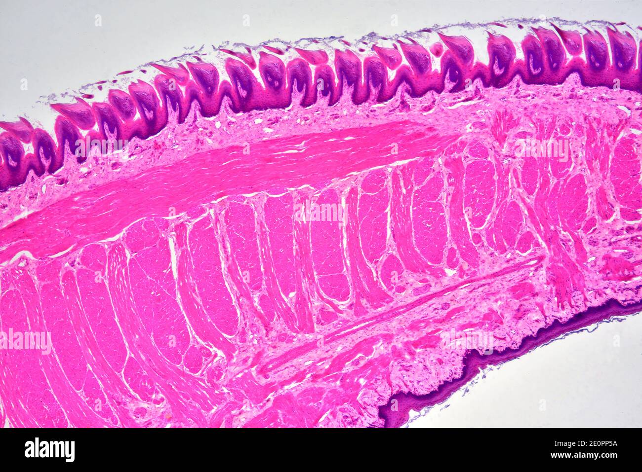 Papillae tongue Banque de photographies et d’images à haute résolution ...