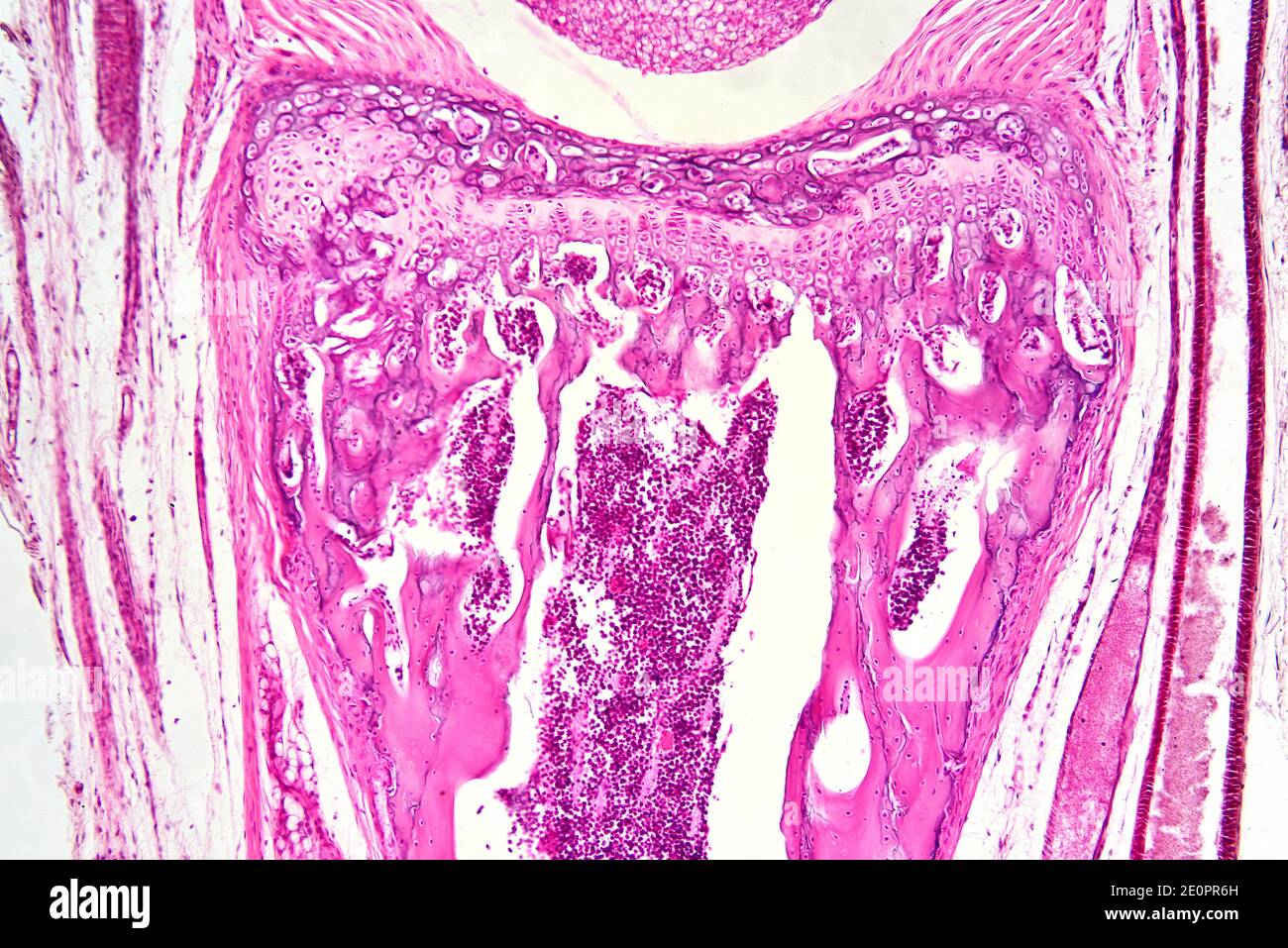 Moelle osseuse rouge Banque de photographies et d’images à haute ...