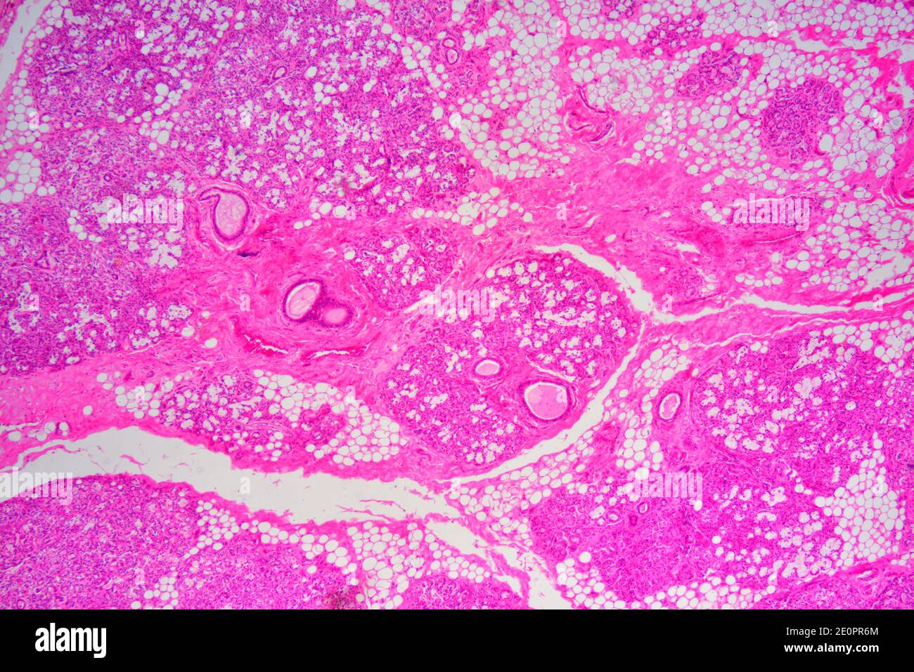 Mucous connective tissue Banque de photographies et d’images à haute ...