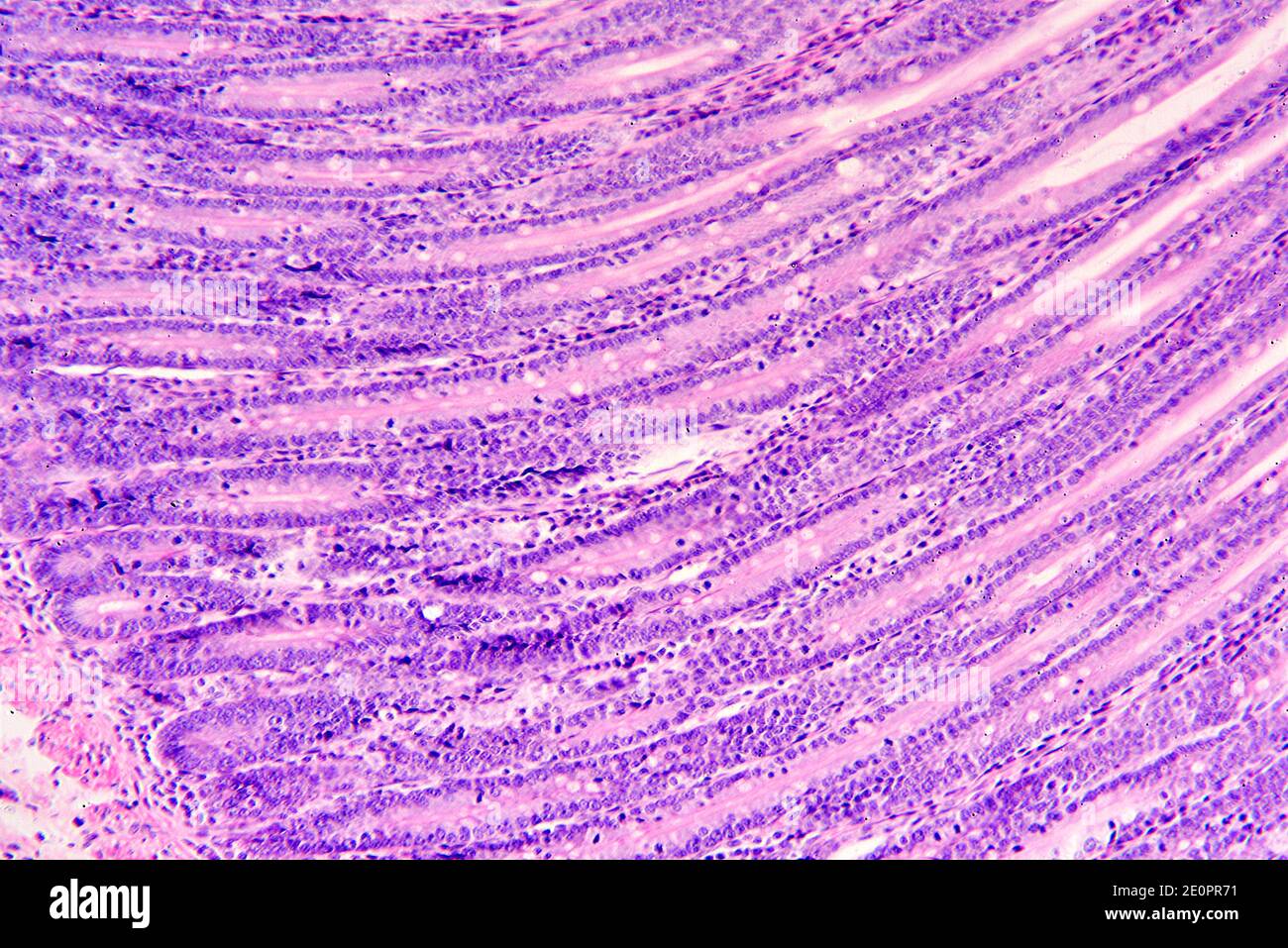 Intestin grêle histologie Banque de photographies et d’images à haute ...