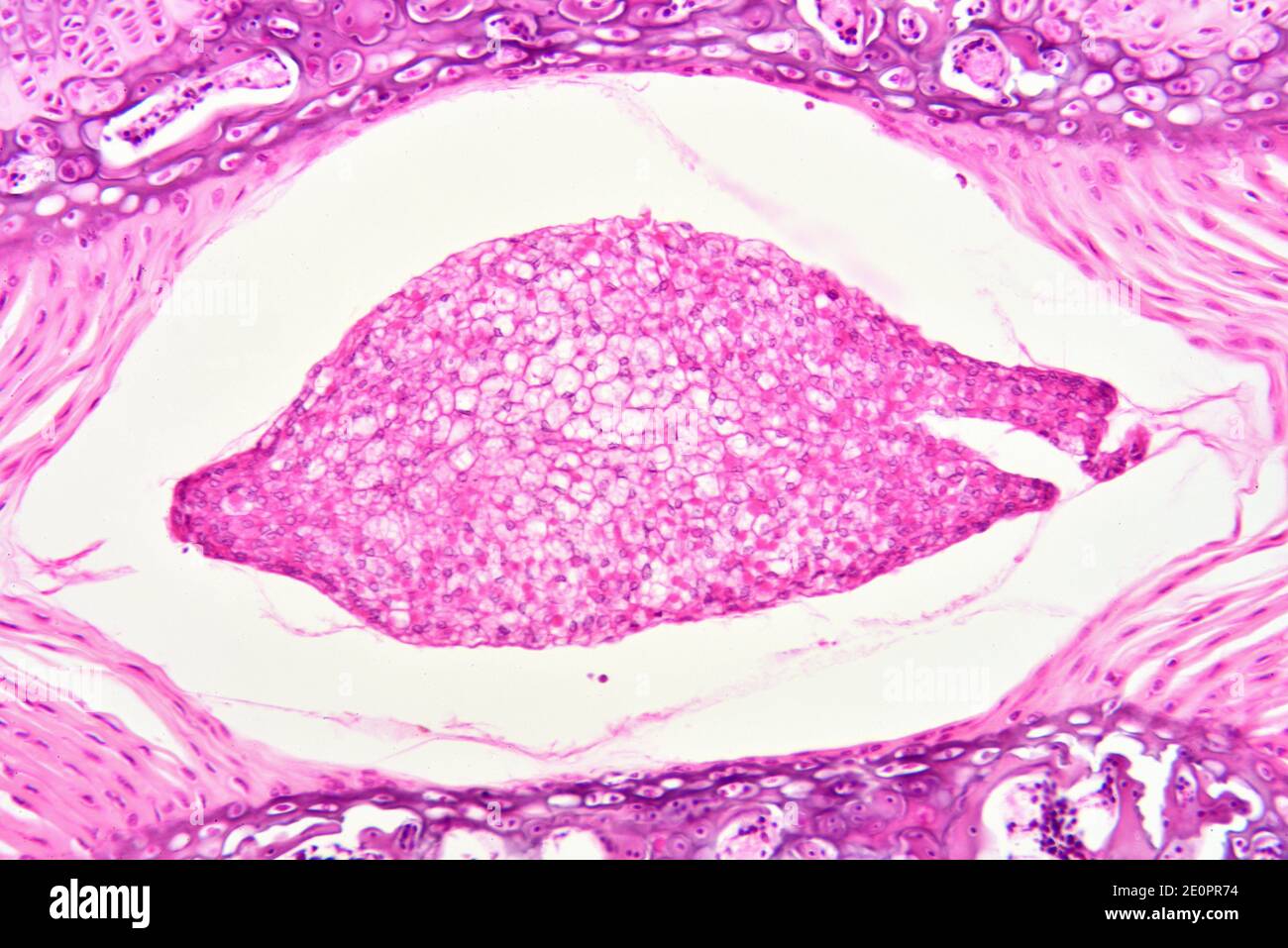 Bone marrow cross section Banque de photographies et d’images à haute ...
